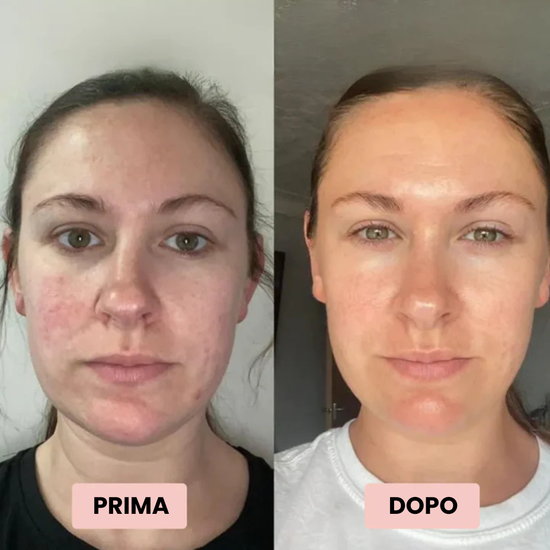 Velora™ - esfoliante al riso – VELORA